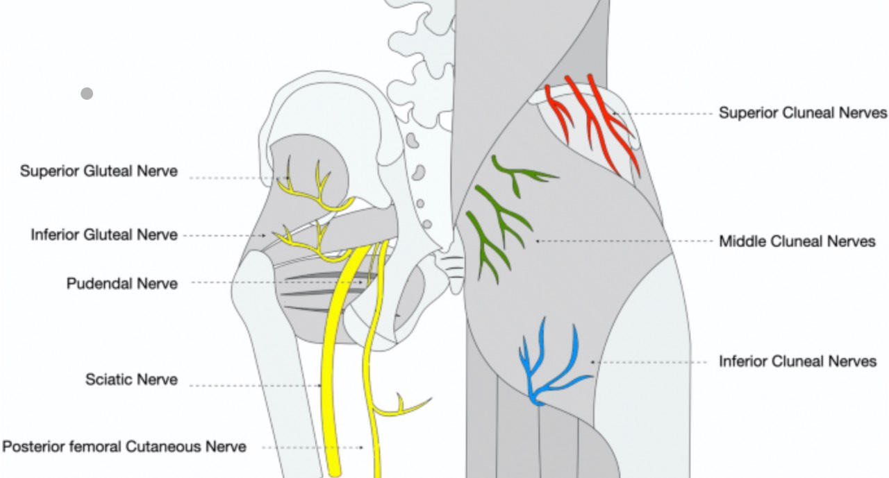 Our Cluneal Nerve Treatment Continues to Help People With Chronic Low ...