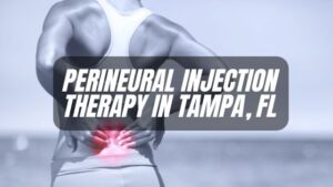 Perineural Injection Therapy in Tampa, FL - Acupuncture , Dry Needling ...