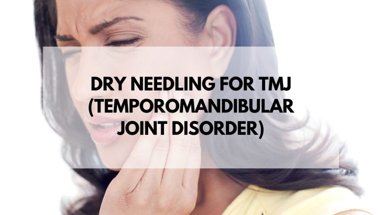 Dry Needling for TMJ (Temporomandibular Joint Disorder) - Acupuncture , Dry Needling ...