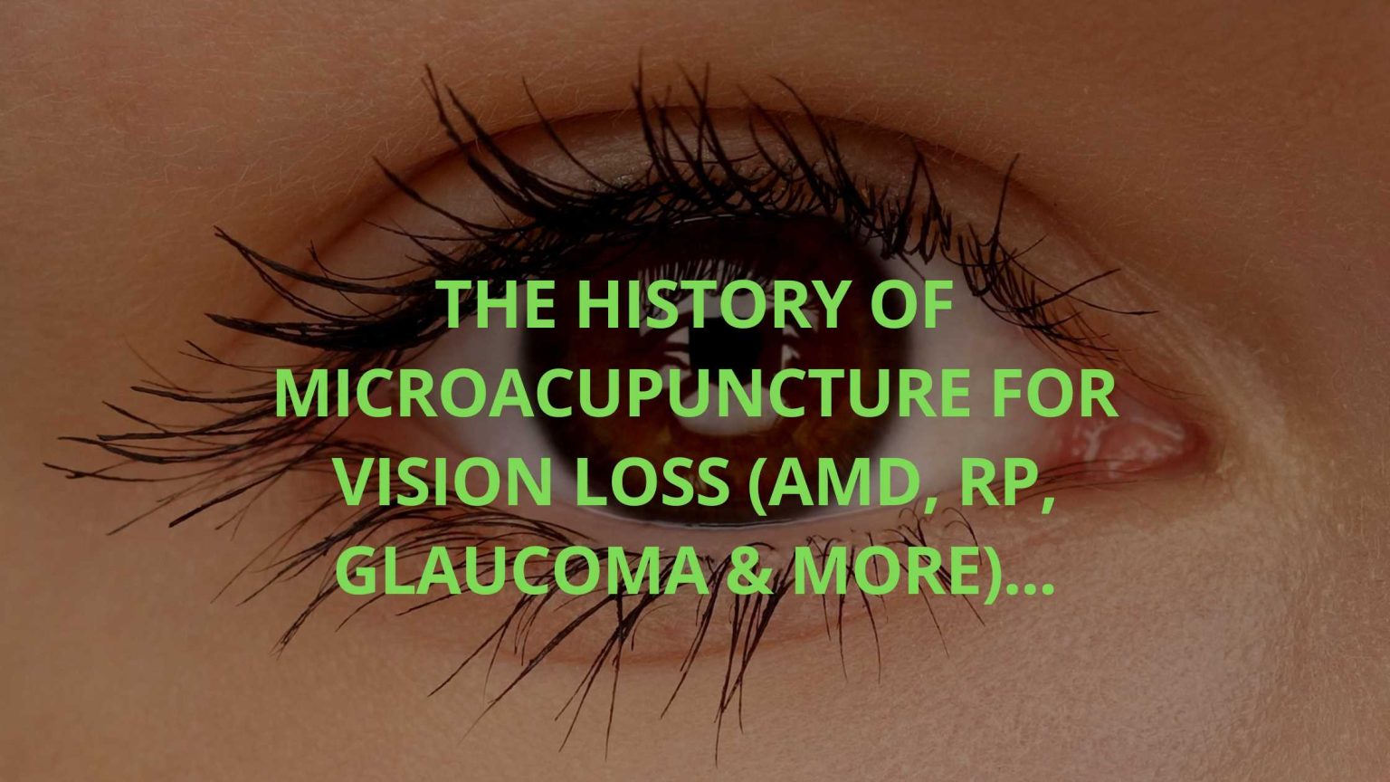 The History of MicroAcupuncture for Vision Loss (AMD, RP, Glaucoma & More)... - Acupuncture ...